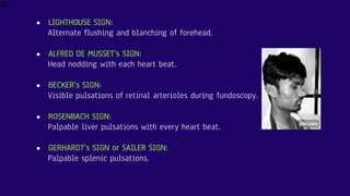 Aortic Regurgitation.pptx