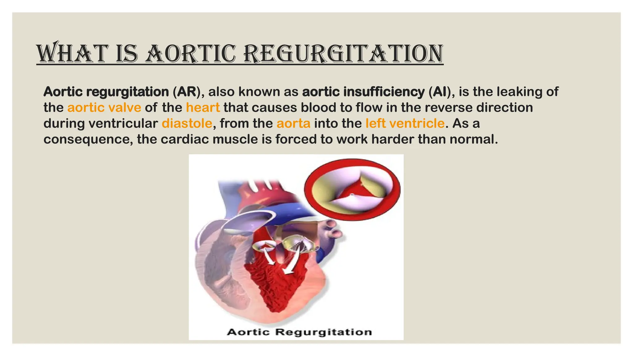 Ppt for medical college aortic regurgitation.pptx