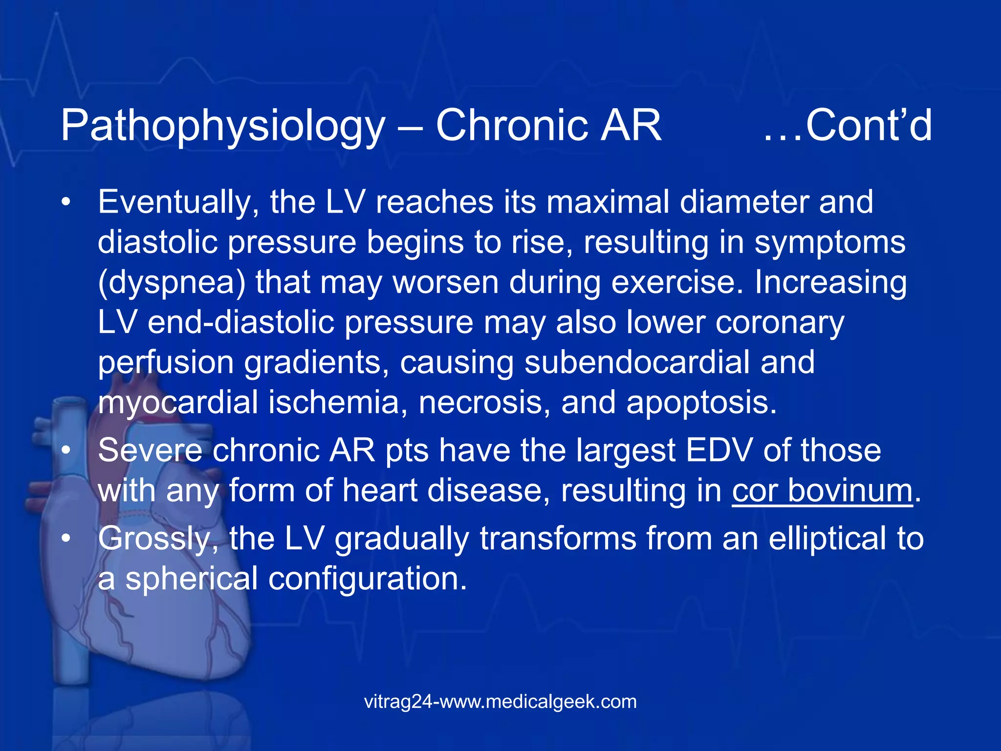 Aortic regurgitation | PPTX