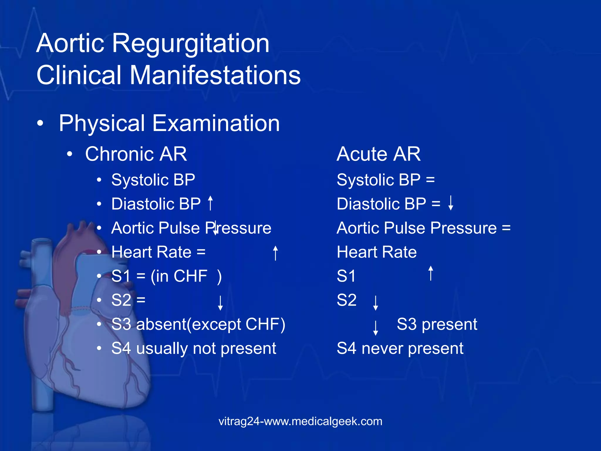 Aortic regurgitation | PPTX