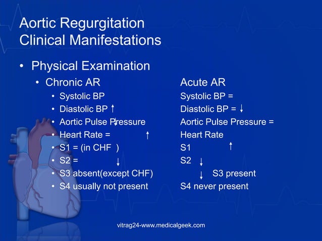 Aortic regurgitation