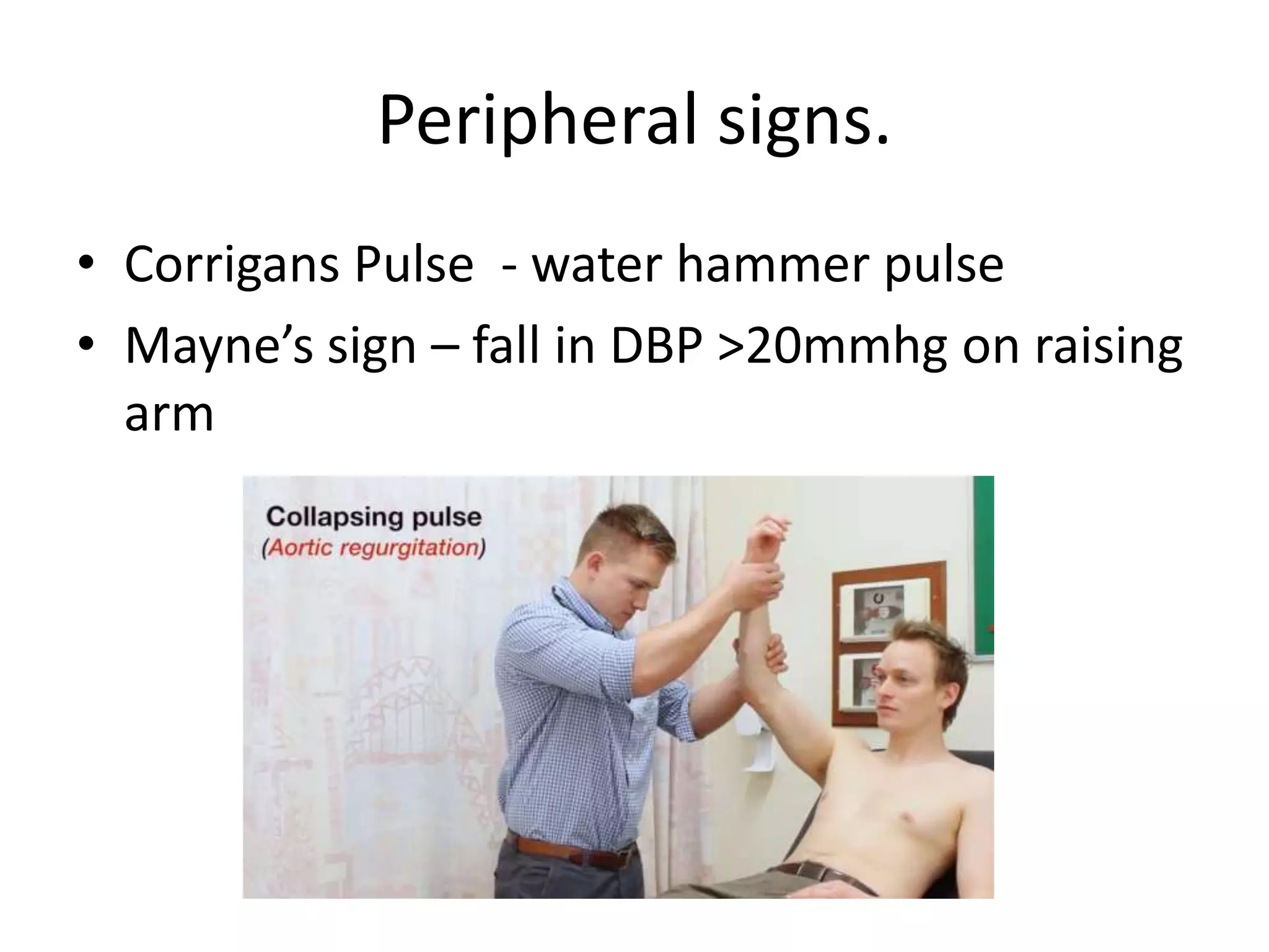 Aortic regurgitation pathophysiology | PPTX