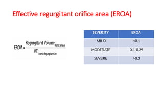 aortic regurgitation Tranesophhageal echocardiographic evaluation | PPTX