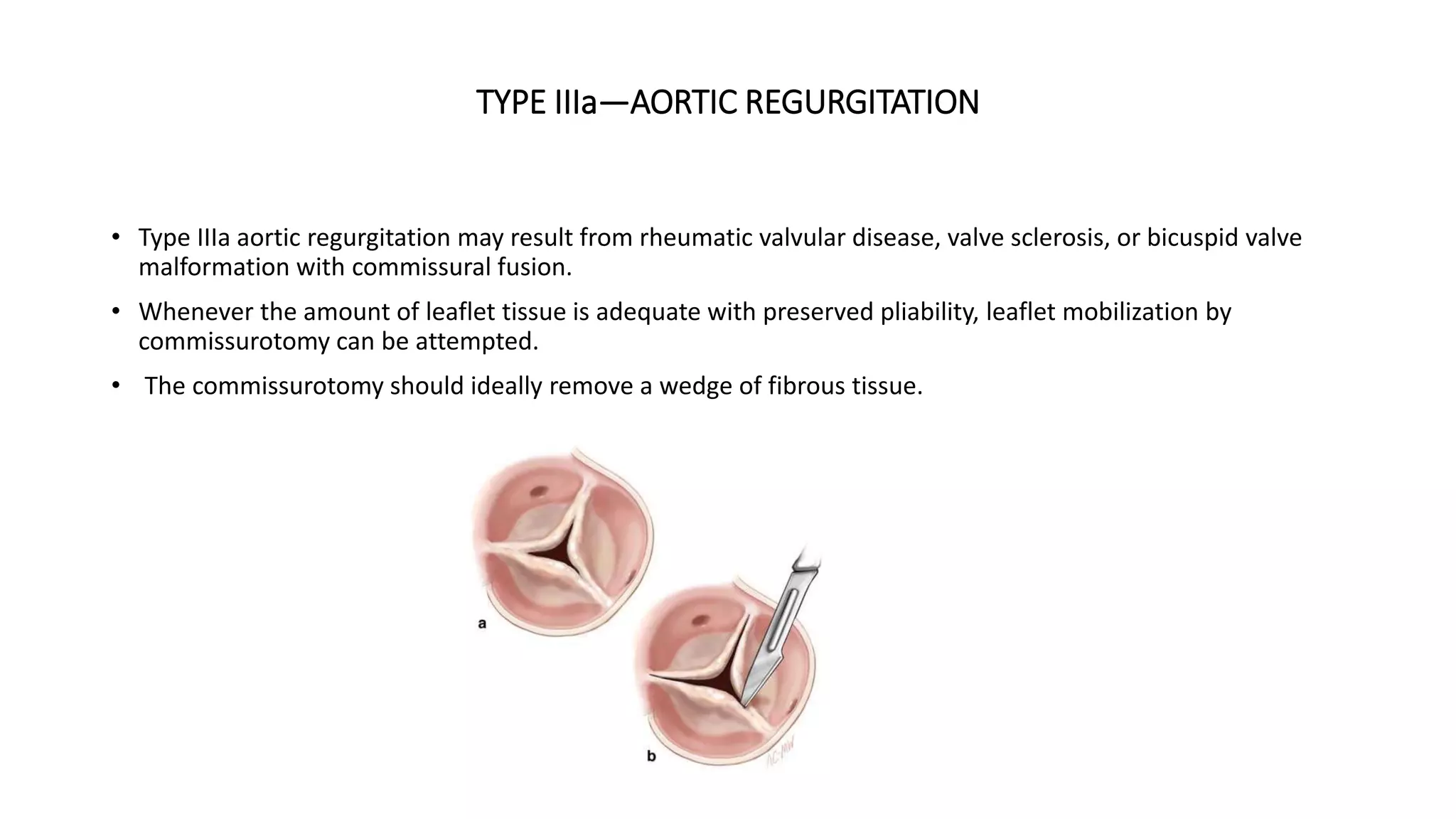 Aortic repair ppt | PPTX