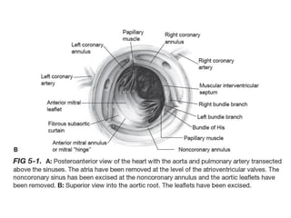 Aortic root anatomy | PPT