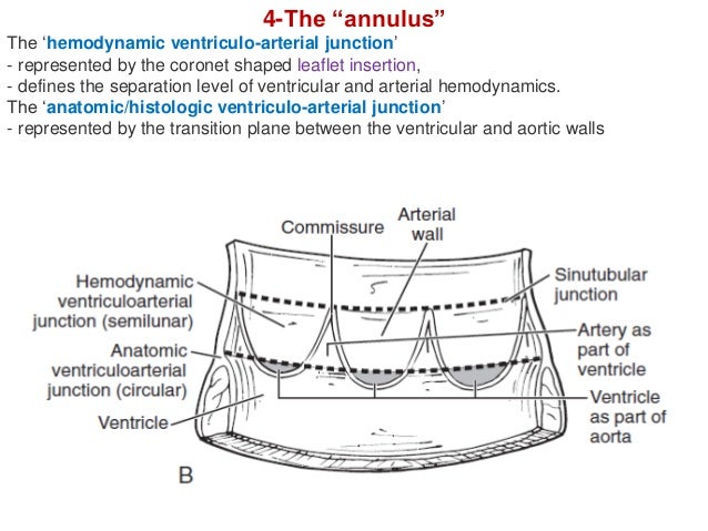 Aortic root anatomy