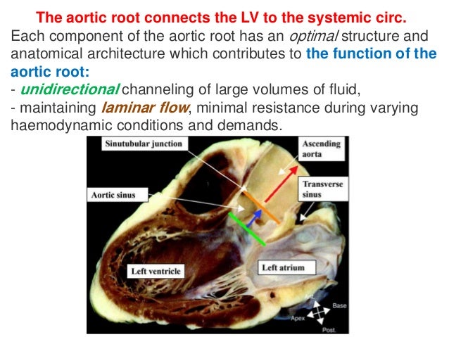 Aortic root anatomy