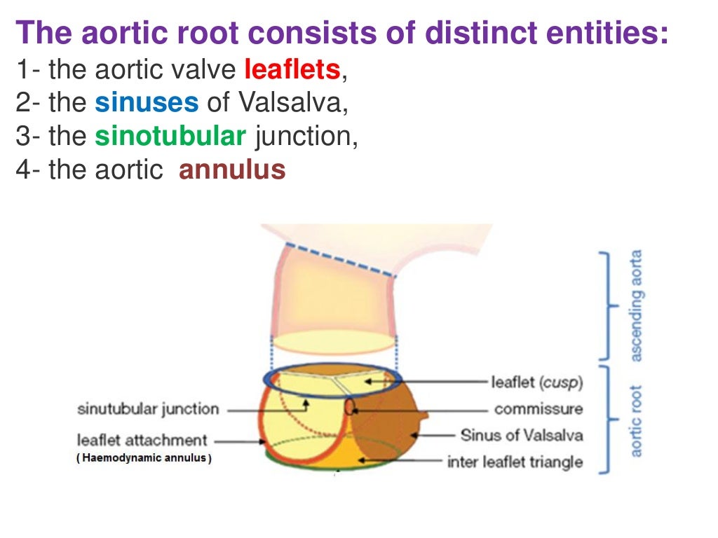 Aortic root anatomy