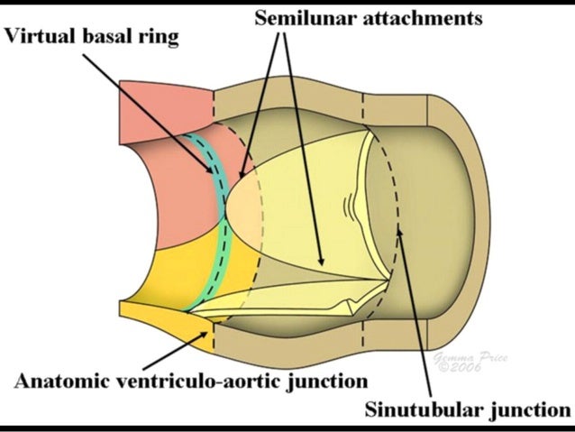 Aortic root surgical anatomy