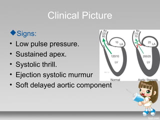 Aortic Stenosis | PPT
