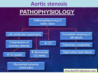 Aortic Stenosis Pathophysiology