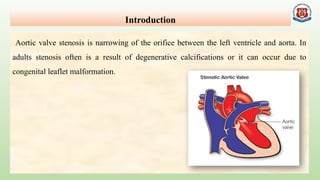 Aortic stenosis and aortic regurgitation | PPTX
