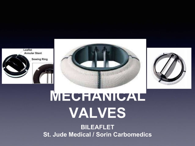 Aortic stenosis and aortic valve replasement | PPT