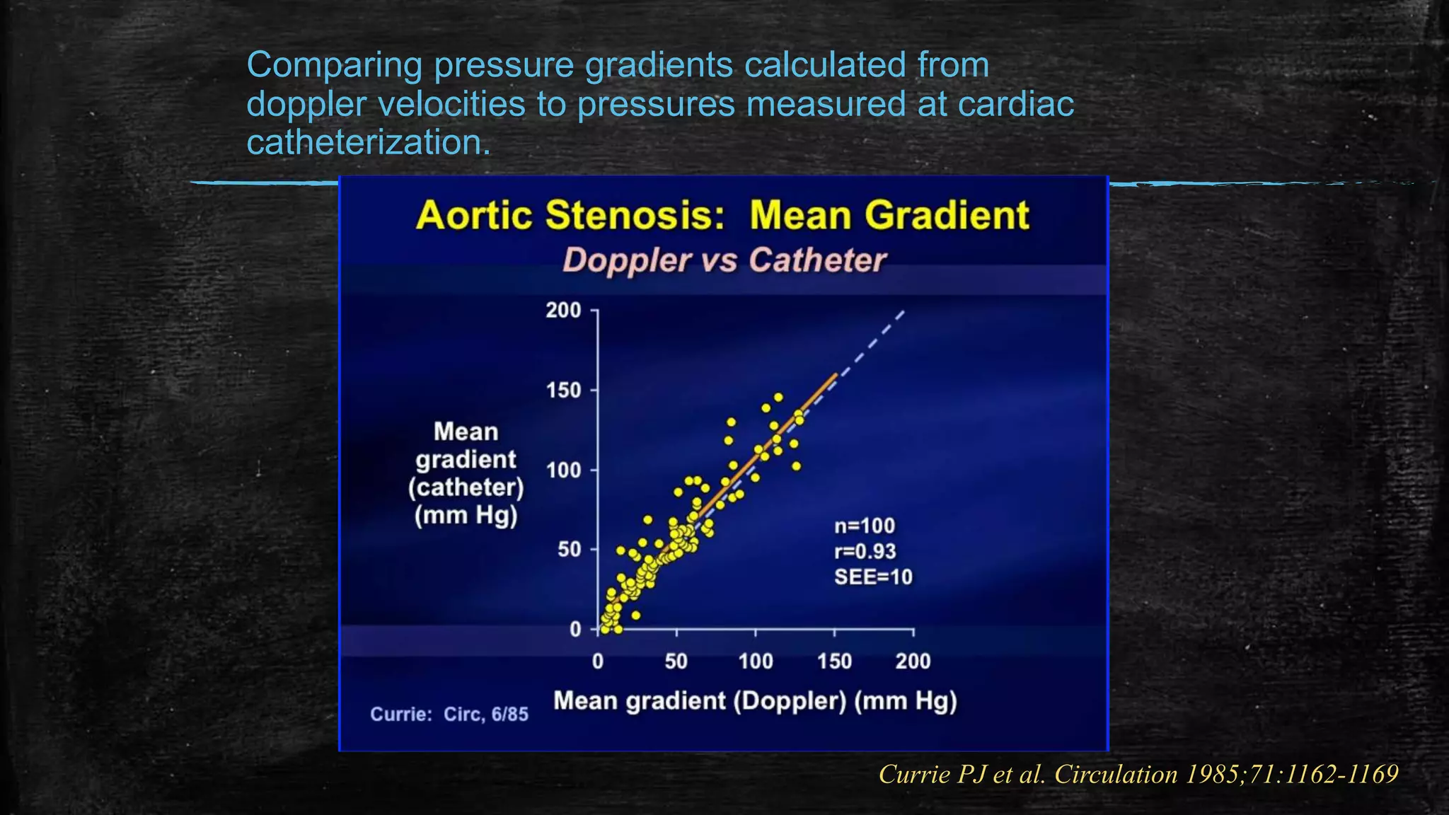 Echocardiography of Aortic stenosis | PPTX