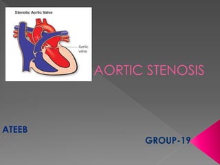 AORTIC STENOSIS PPT.pptx
