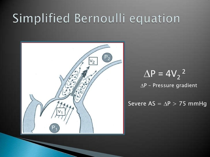 Aortic valve assessment