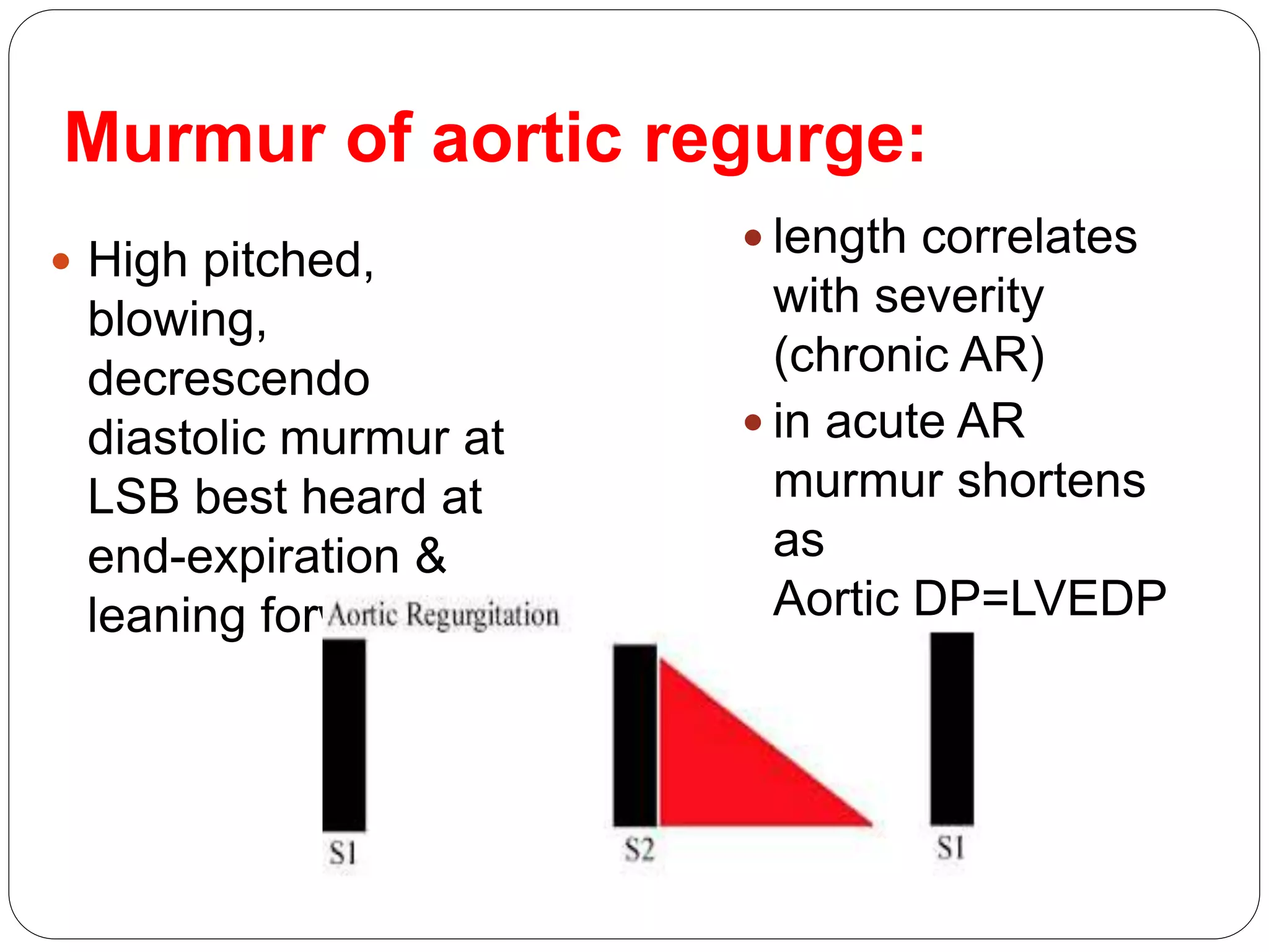 Aortic valve disease | PPTX