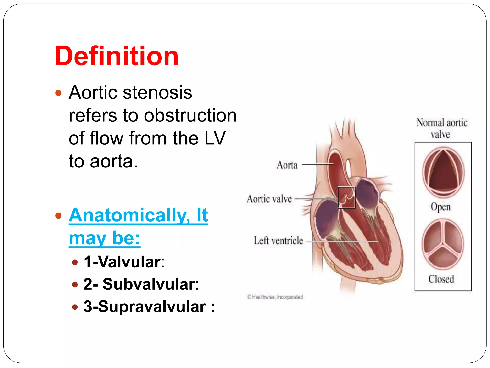 Aortic valve disease | PPTX