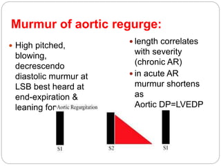 Aortic valve disease | PPTX