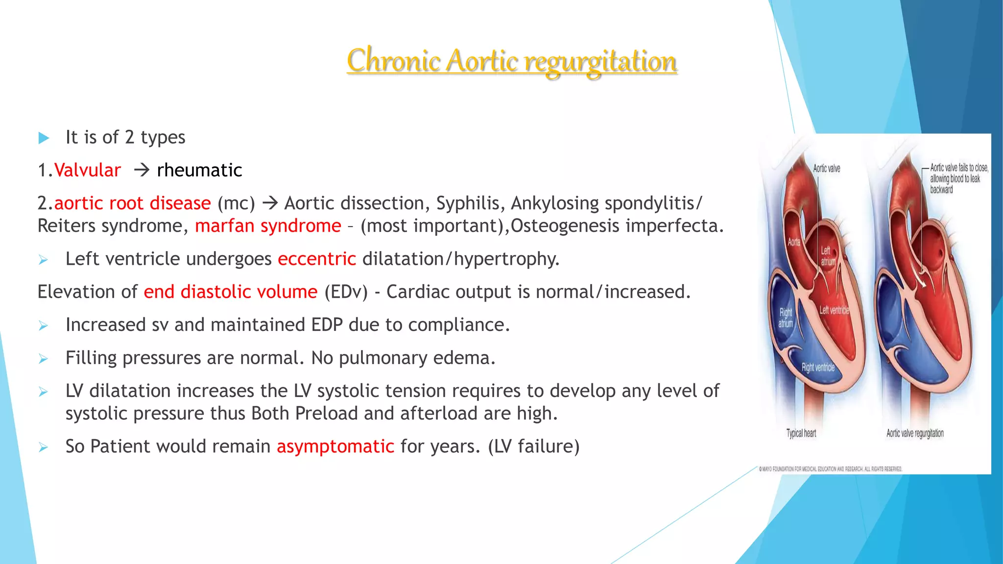 aortic valve disease.pptx