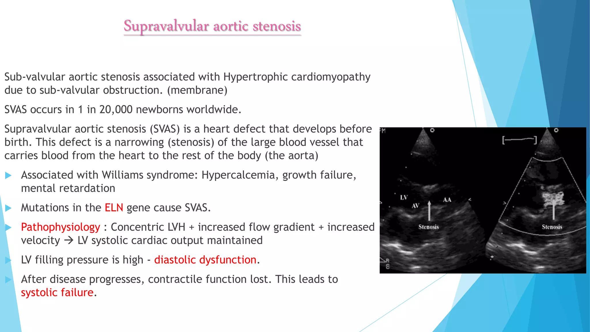 aortic valve disease.pptx