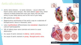 aortic valve disease.pptx
