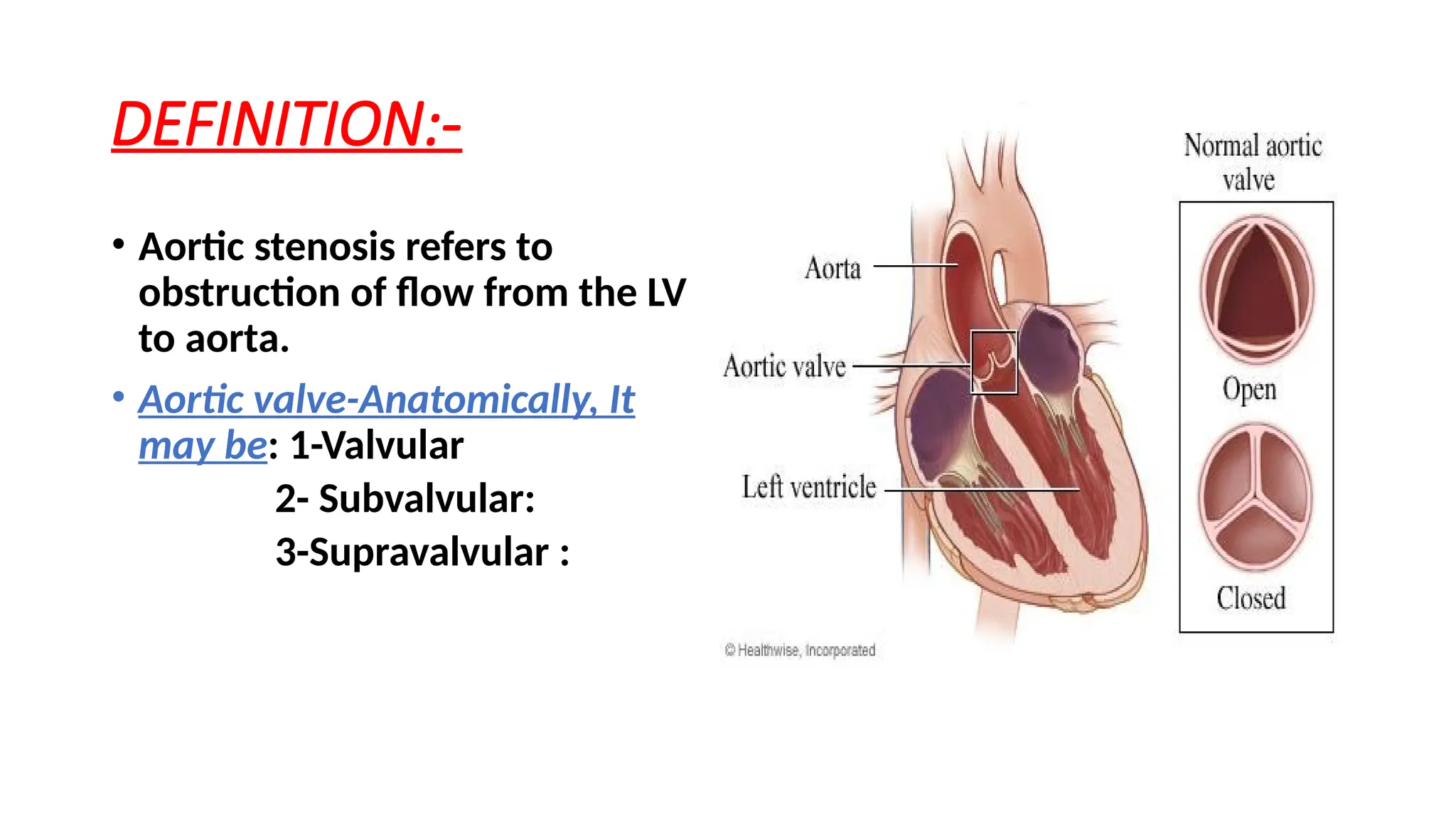 Aortic valve anatomy and its disease.pptx