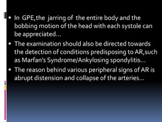 AORTIC VALVE DS.pptx