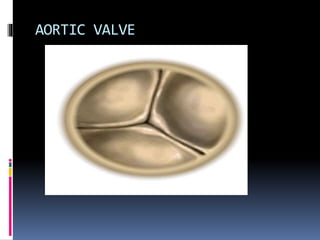 AORTIC VALVE DS.pptx