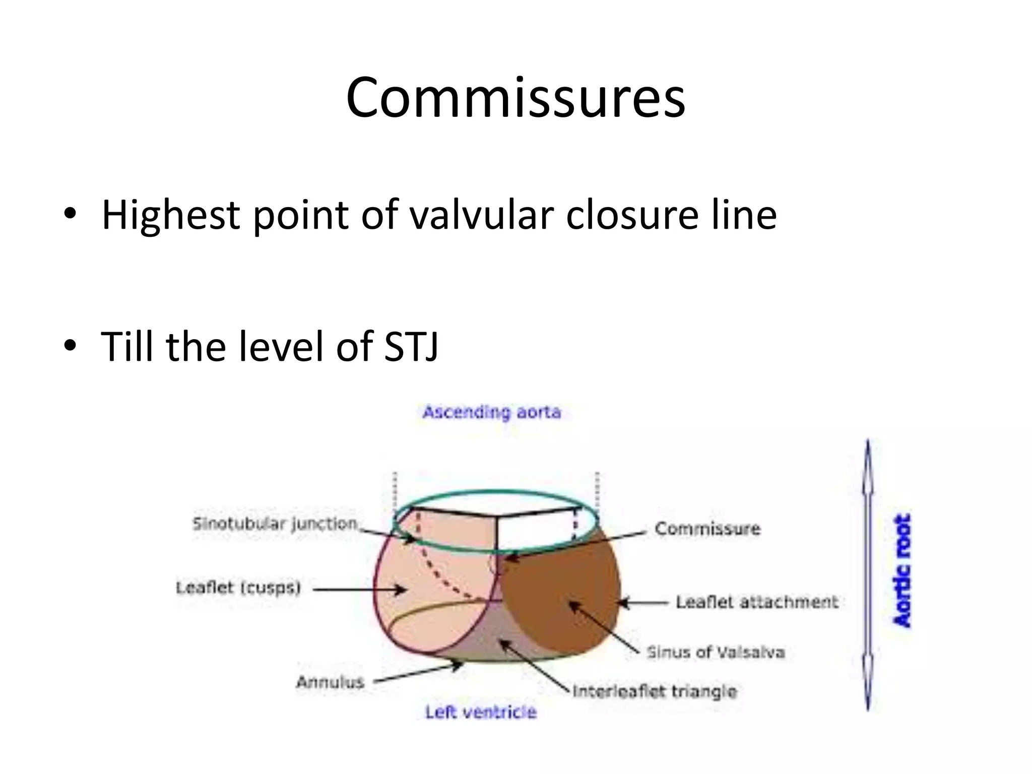 Aortic valve anatomy presentation | PPTX