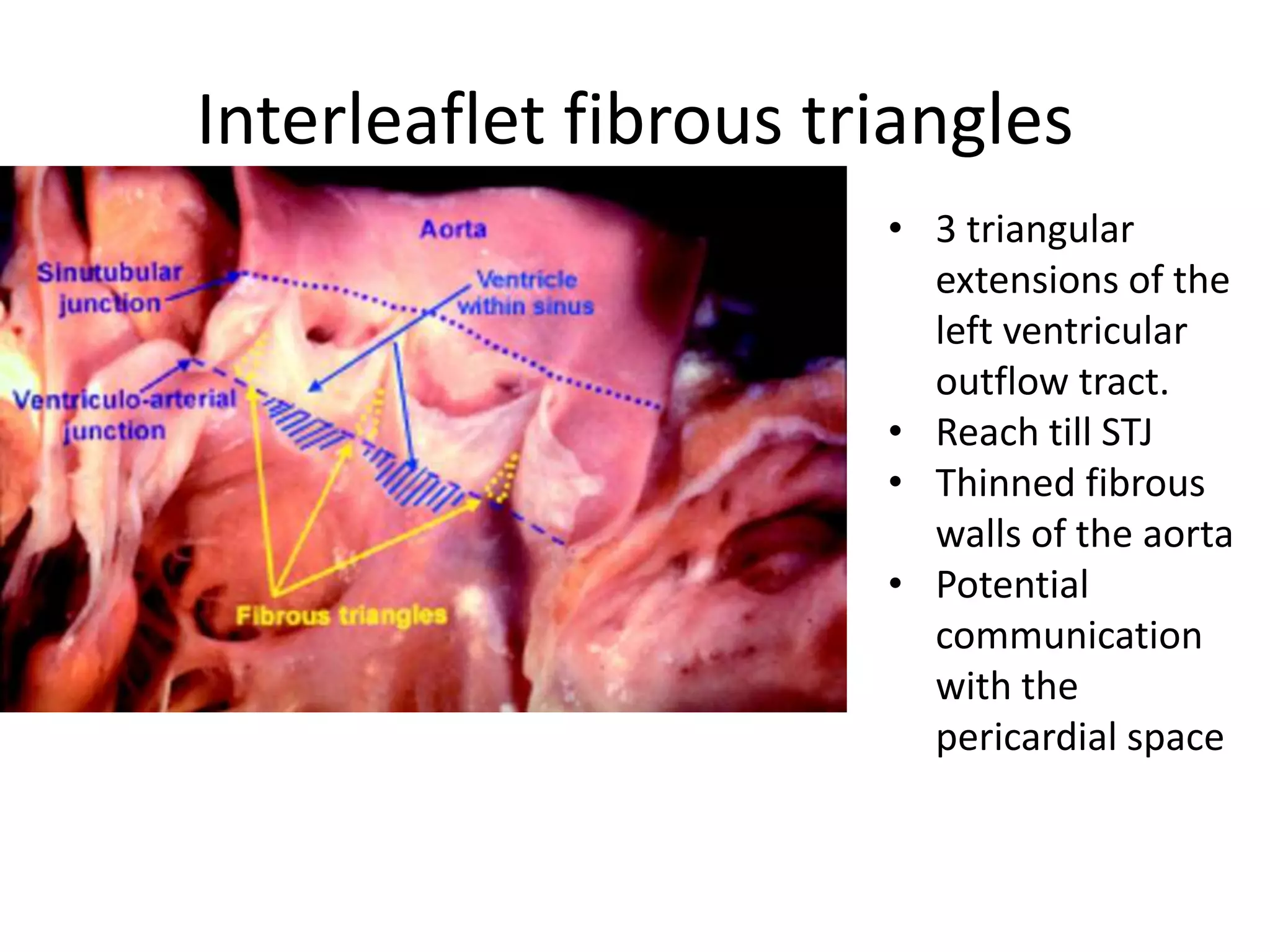 Aortic valve anatomy presentation | PPTX