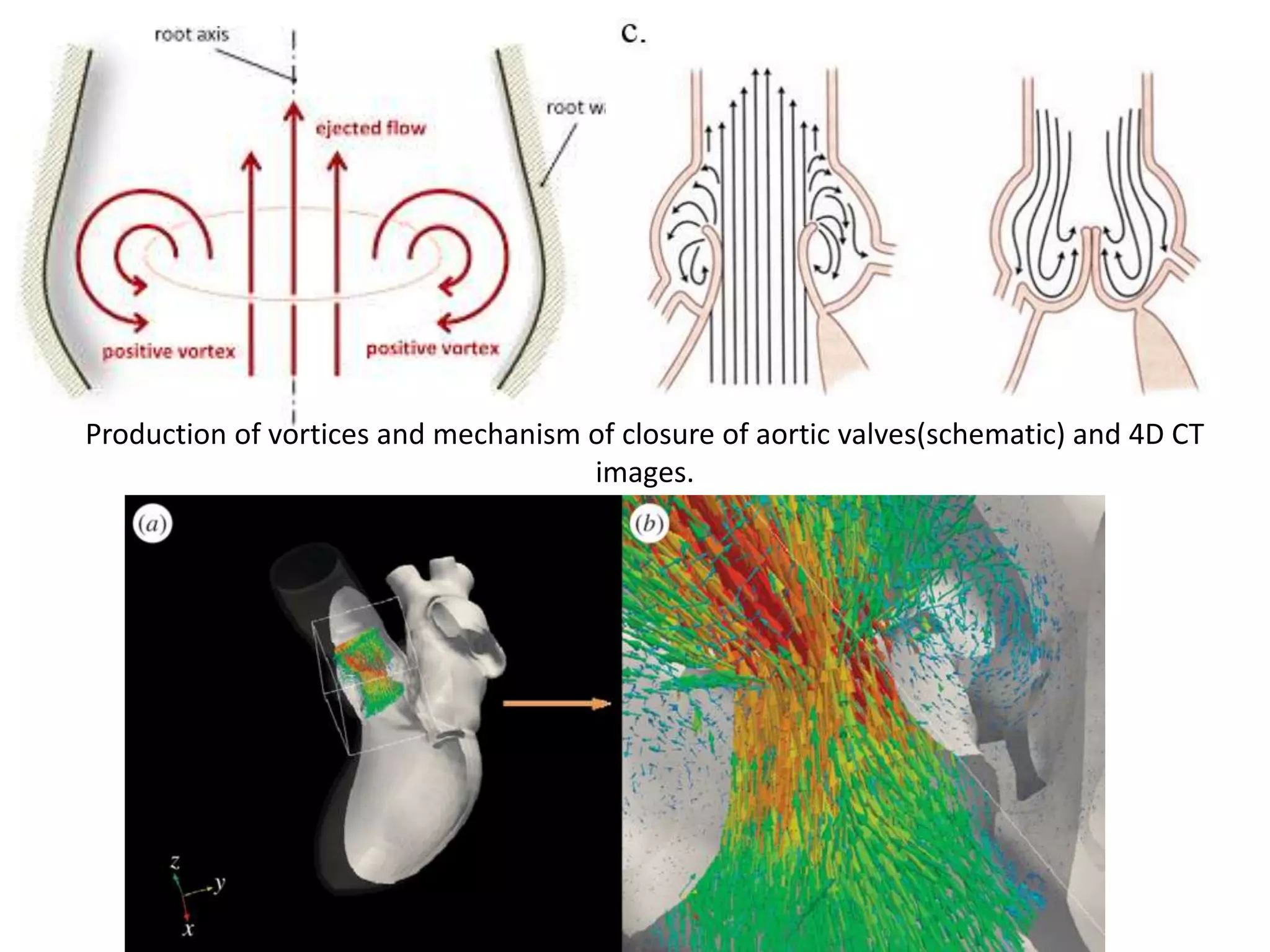 Aortic valve anatomy presentation | PPTX