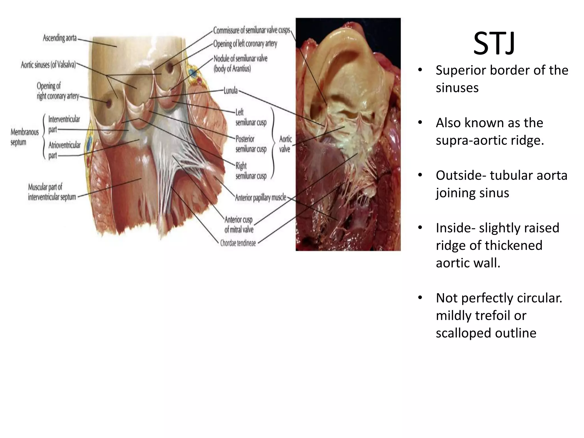 Aortic valve anatomy presentation | PPTX