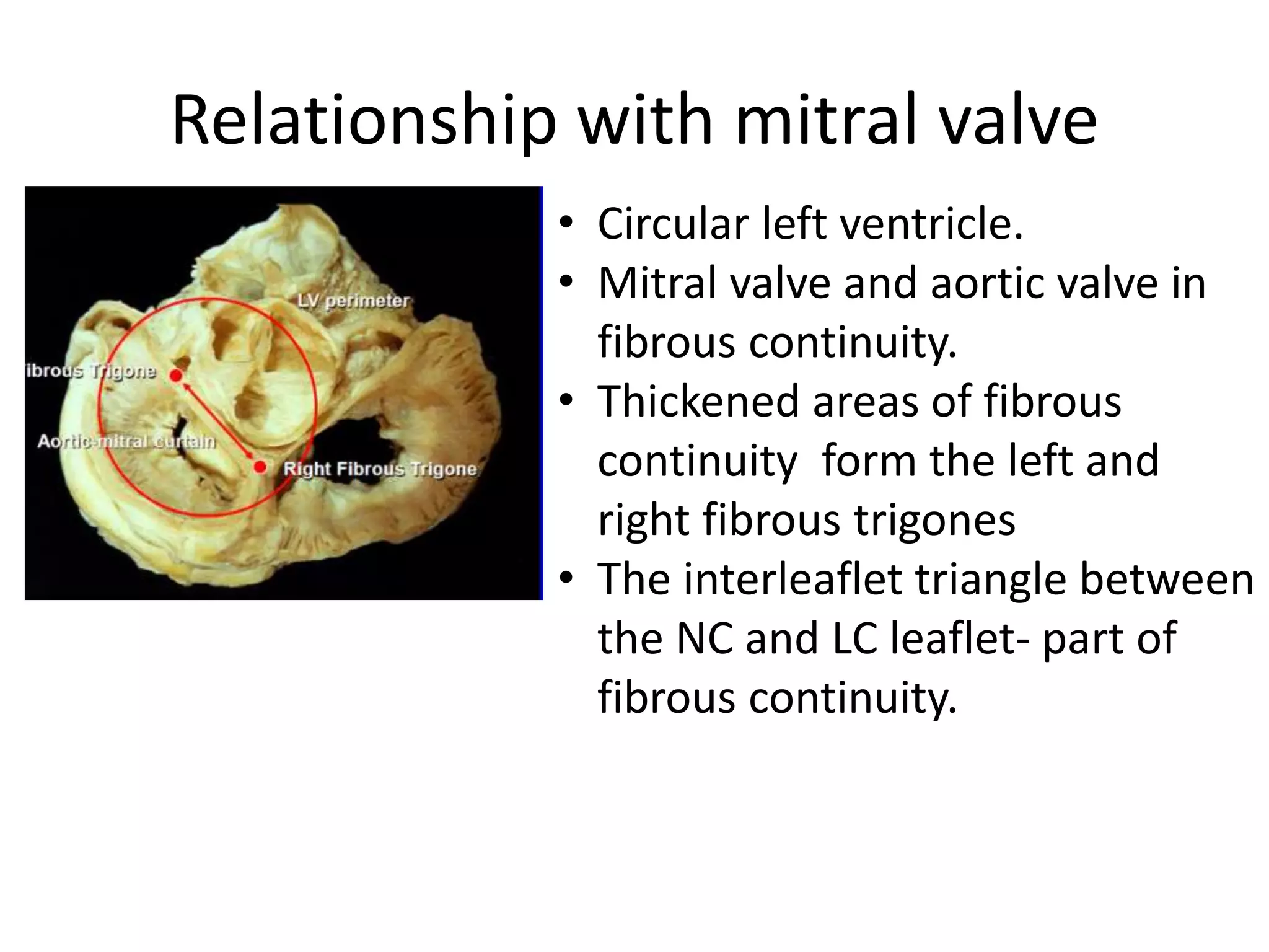 Aortic valve anatomy presentation | PPTX