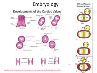 Aortic valve anatomy presentation | PPTX