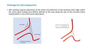 Aorto-Ostial Lesions.pptx