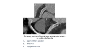 Aorto-Ostial Lesions.pptx