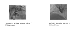 Aorto-Ostial Lesions.pptx