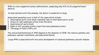 Aorto pulmonary window may 2021 | PDF
