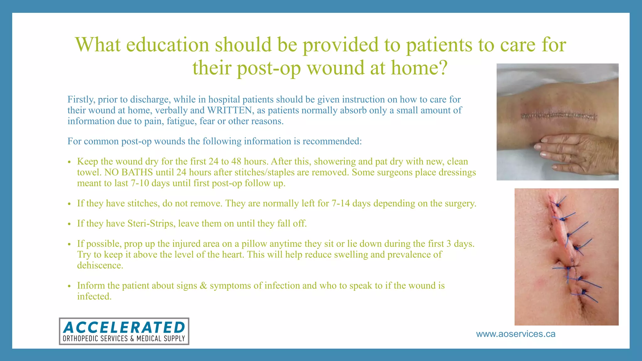 Basic Wound Care by Kathleen Cesarin, CEO of Accelerated | PPT