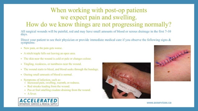 Basic Wound Care by Kathleen Cesarin, CEO of Accelerated | PPT