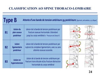 AO SPINE CLASSIFICATION IN SPÎE TRAUMA.pptx