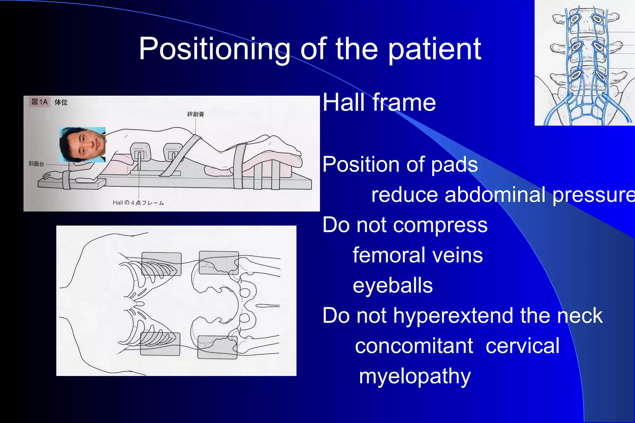 AOSPINE2010TLIF | PPT