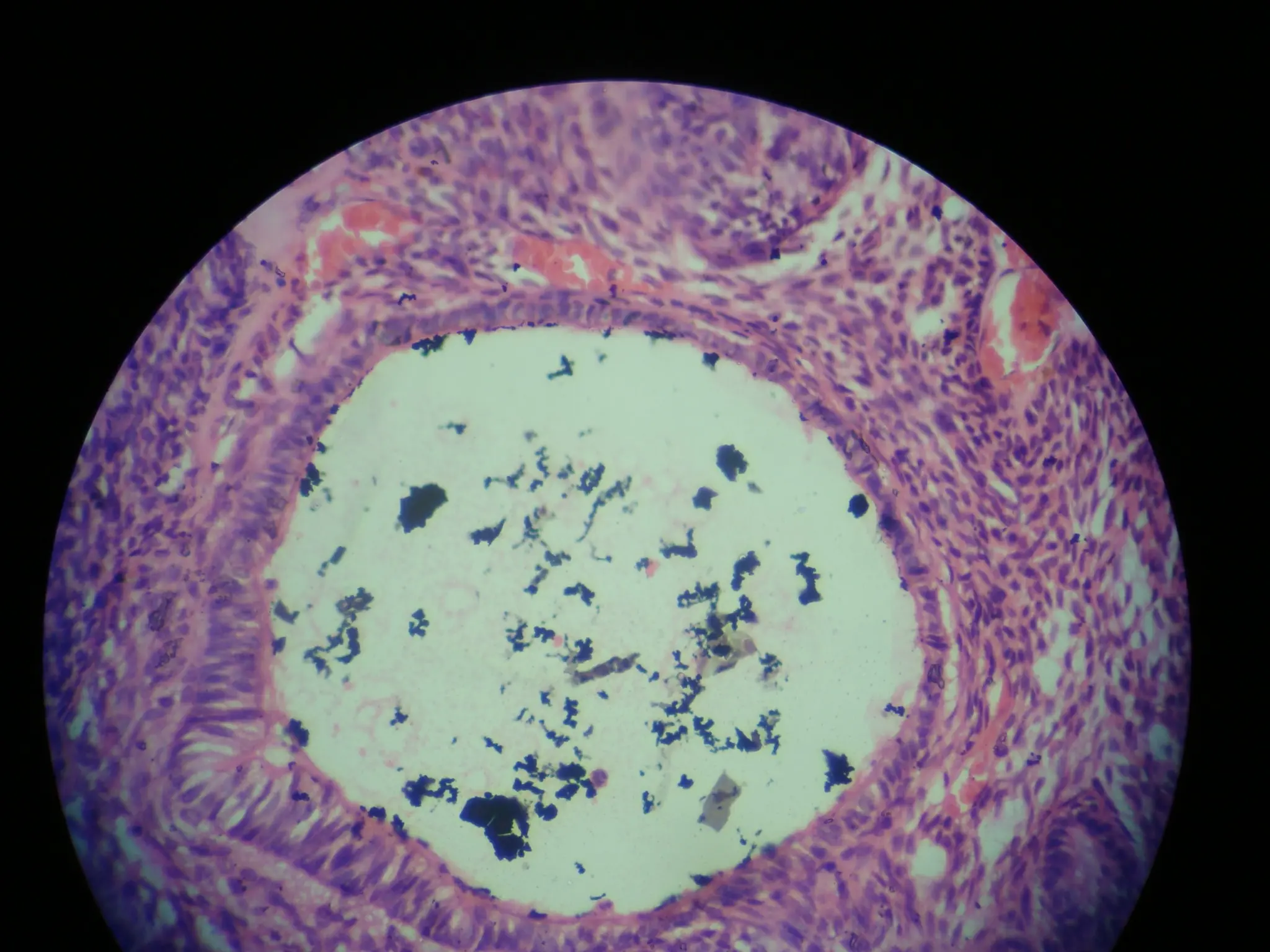 AOT -Path.pptxjijojknknknomlmkookojjknnkl | PPTX