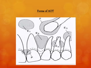 Aot,ceot | PPTX
