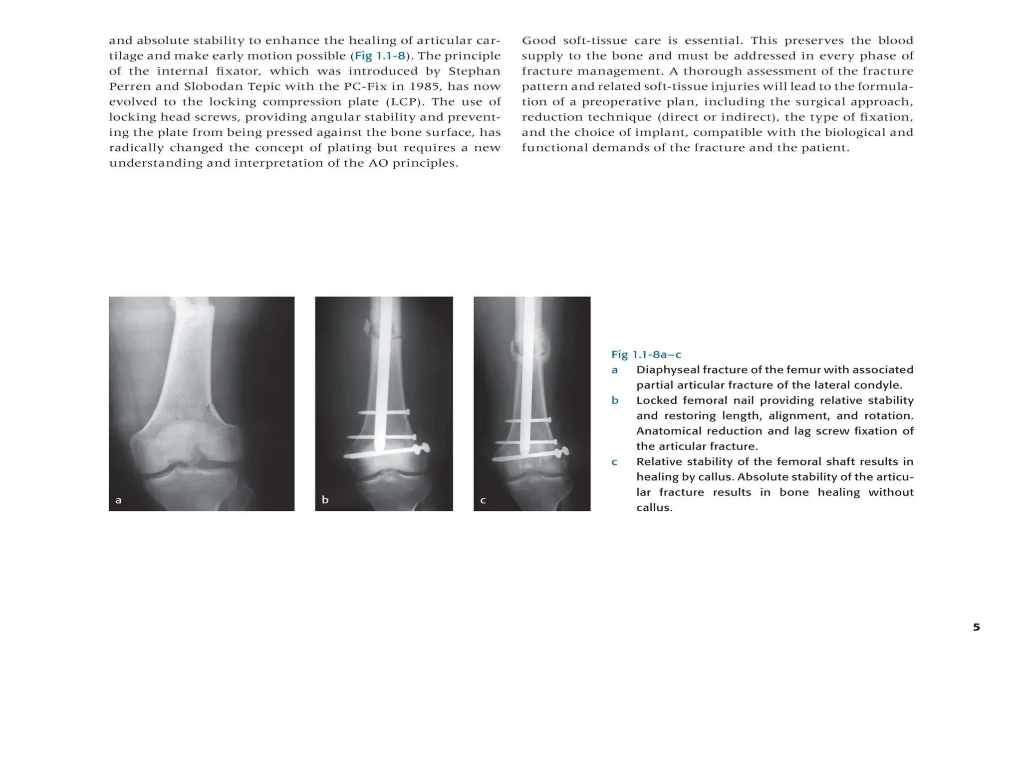 AO Trauma orthopaedic principle of fracture management .pptx