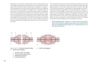 AO Trauma orthopaedic principle of fracture management .pptx