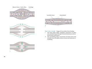 AO Trauma orthopaedic principle of fracture management .pptx