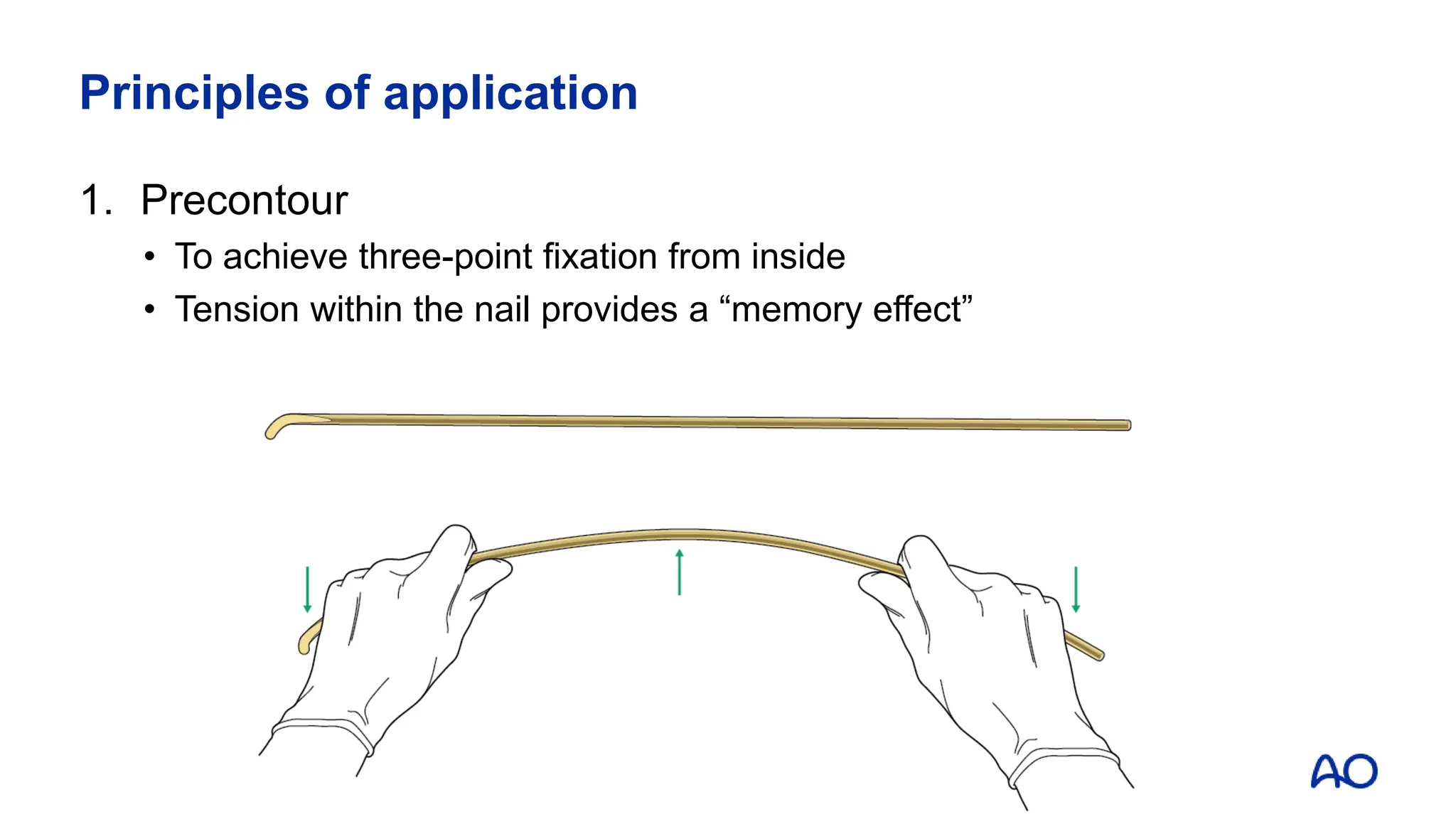 AO Trauma Pediatrics - Elastic nailing - M Kremli 2022.pptx