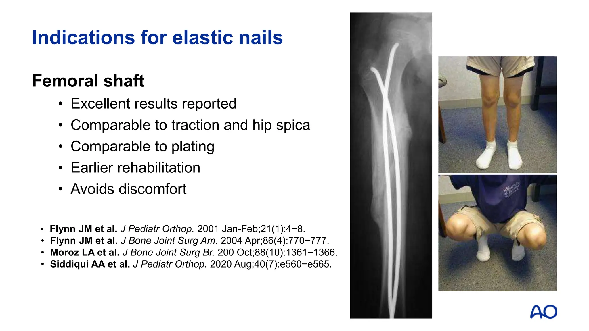 AO Trauma Pediatrics - Elastic nailing - M Kremli 2022.pptx